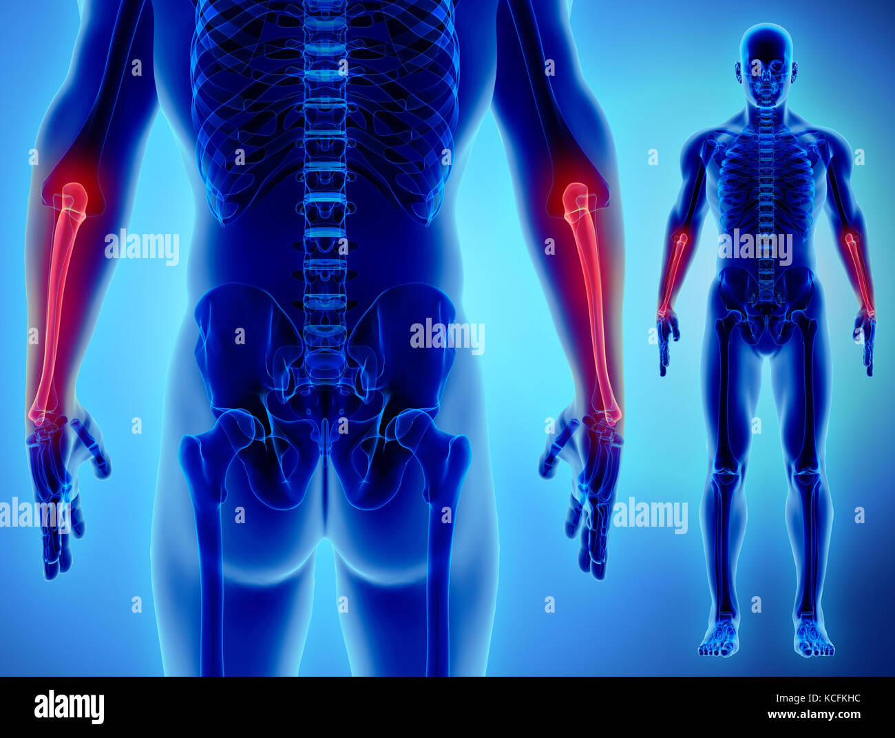 3d illustration de cubitus - partie de squelette humain Photo Stock - Alamy