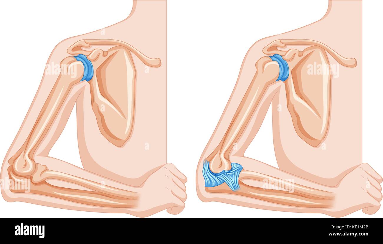 Anatomie du coude Banque d'images vectorielles - Alamy