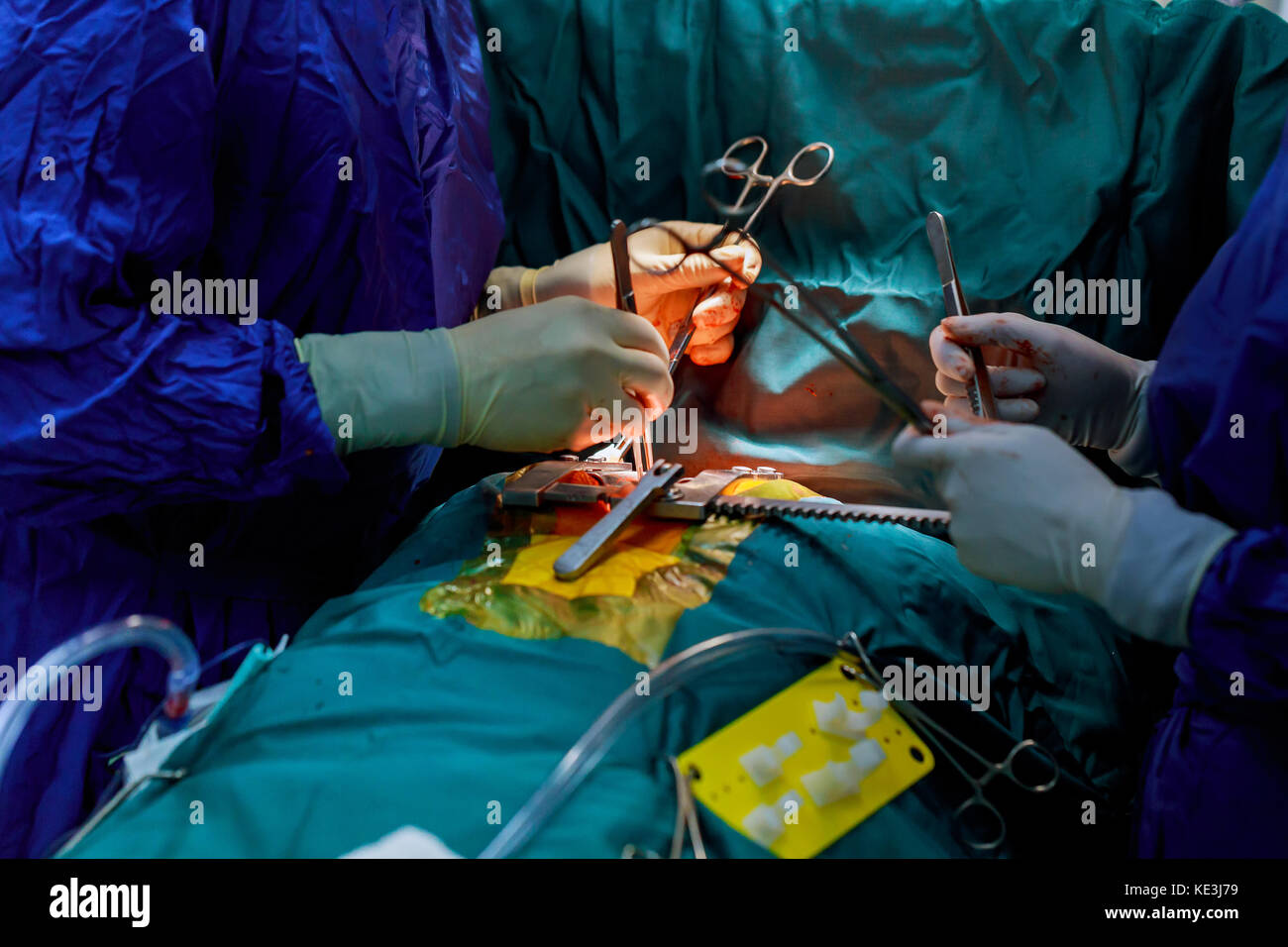 Chirurgien cardiaque Banque de photographies et d’images à haute résolution - Alamy