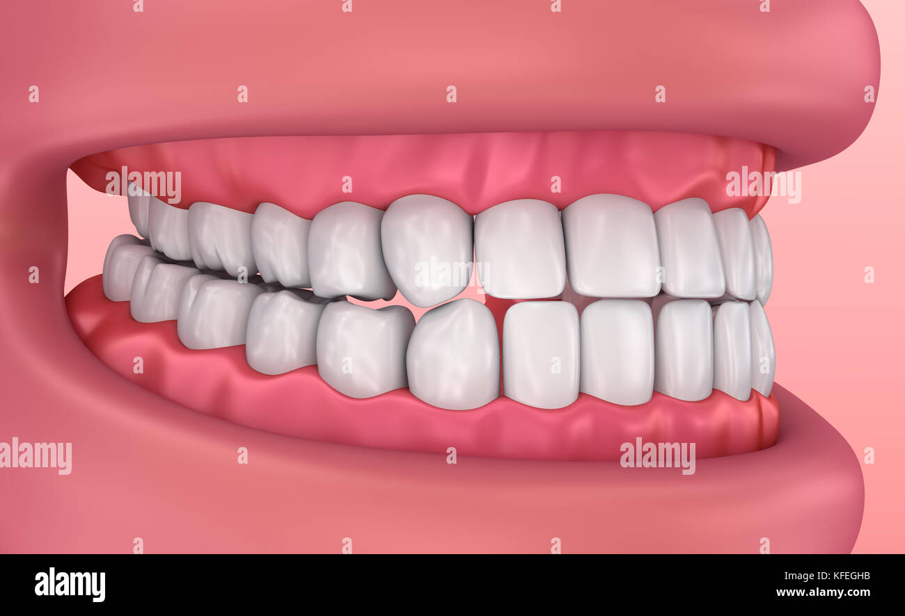 Anatomie de la langue 3d Banque de photographies et d’images à haute ...
