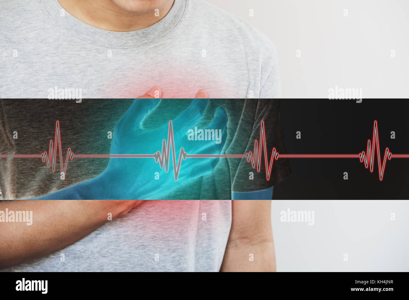 Un homme de toucher son coeur, avec le pouls signe. crise cardiaque ...