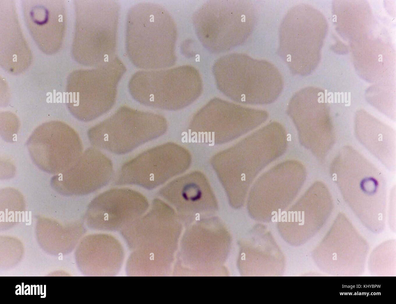 Plasmodium falciparum Banque de photographies et d’images à haute ...