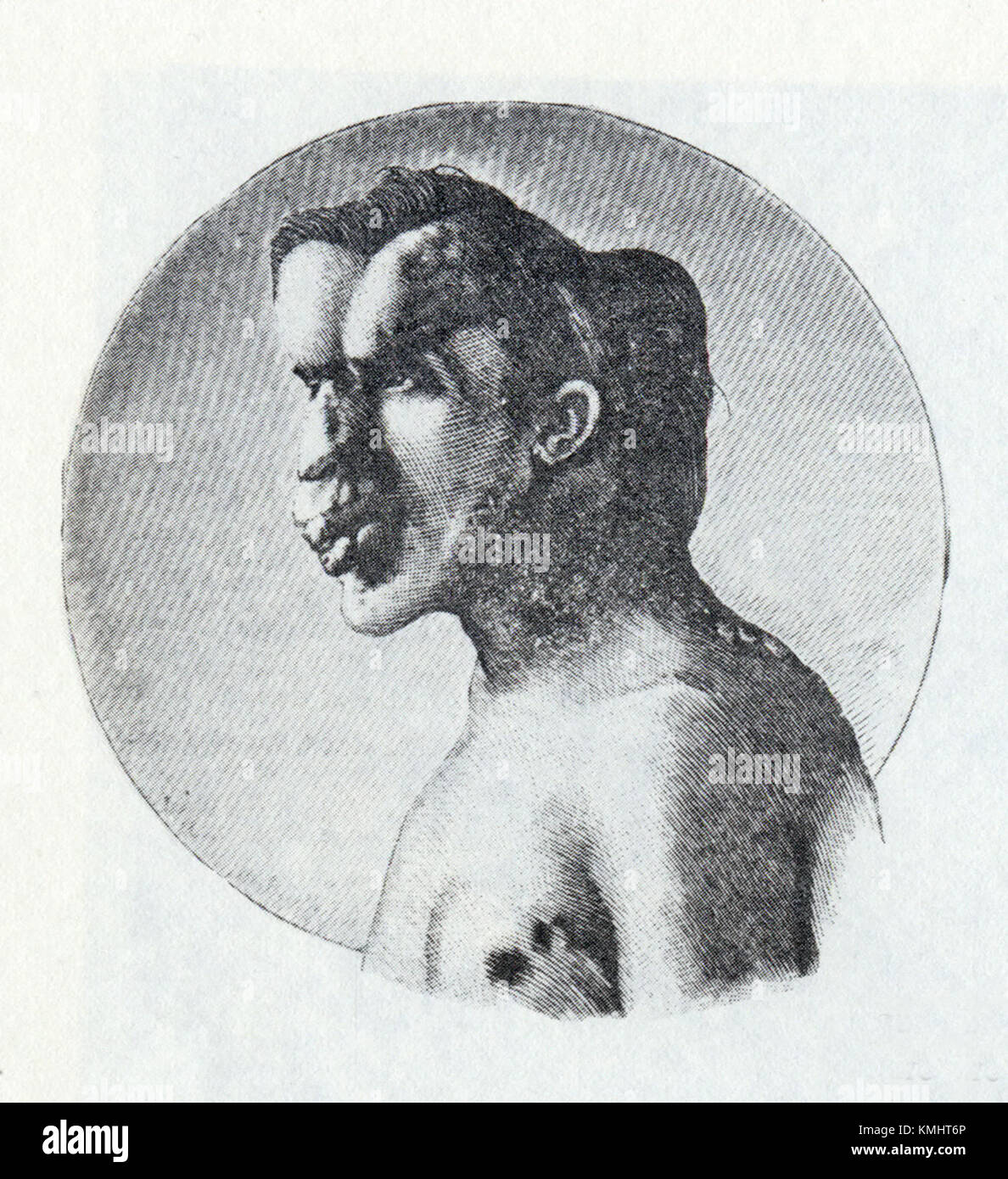 Joseph merrick Banque de photographies et d’images à haute résolution ...