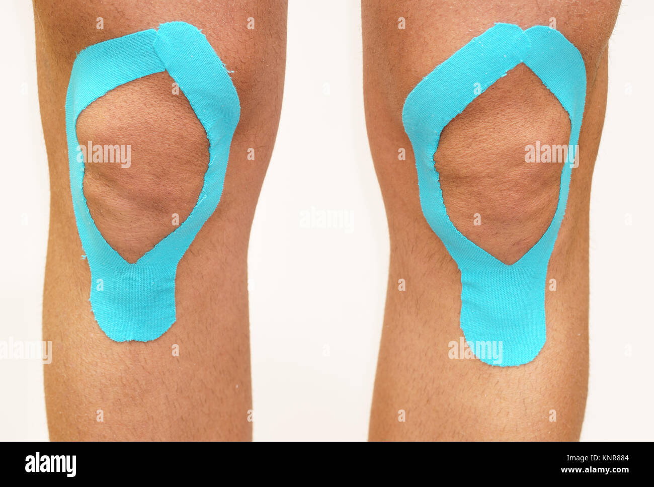 La technique du genou. Kinesiology Tape, fond blanc Photo Stock - Alamy