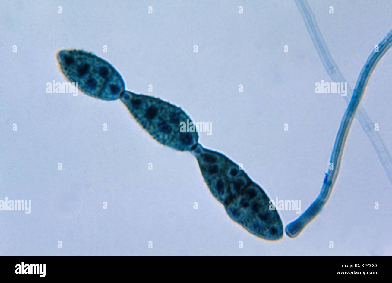 Alternaria conidies Banque de photographies et d’images à haute ...