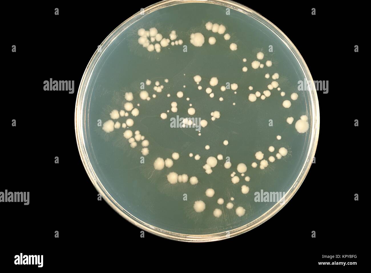 Il s'agit d'une culture de la plaque le champignon Candida albicans ...