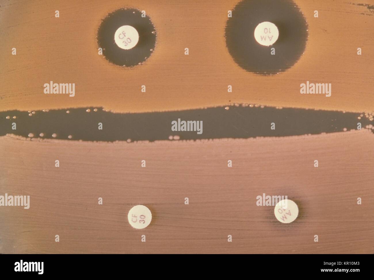 E cloacae Banque de photographies et d’images à haute résolution - Alamy