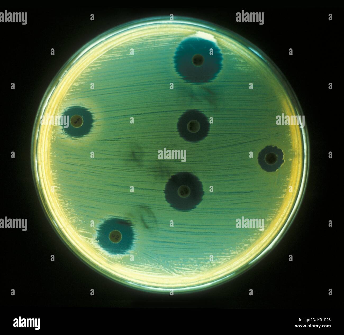 Les bactéries aérobies, Staphylococcus aureus, cultivés sur une plaque ...