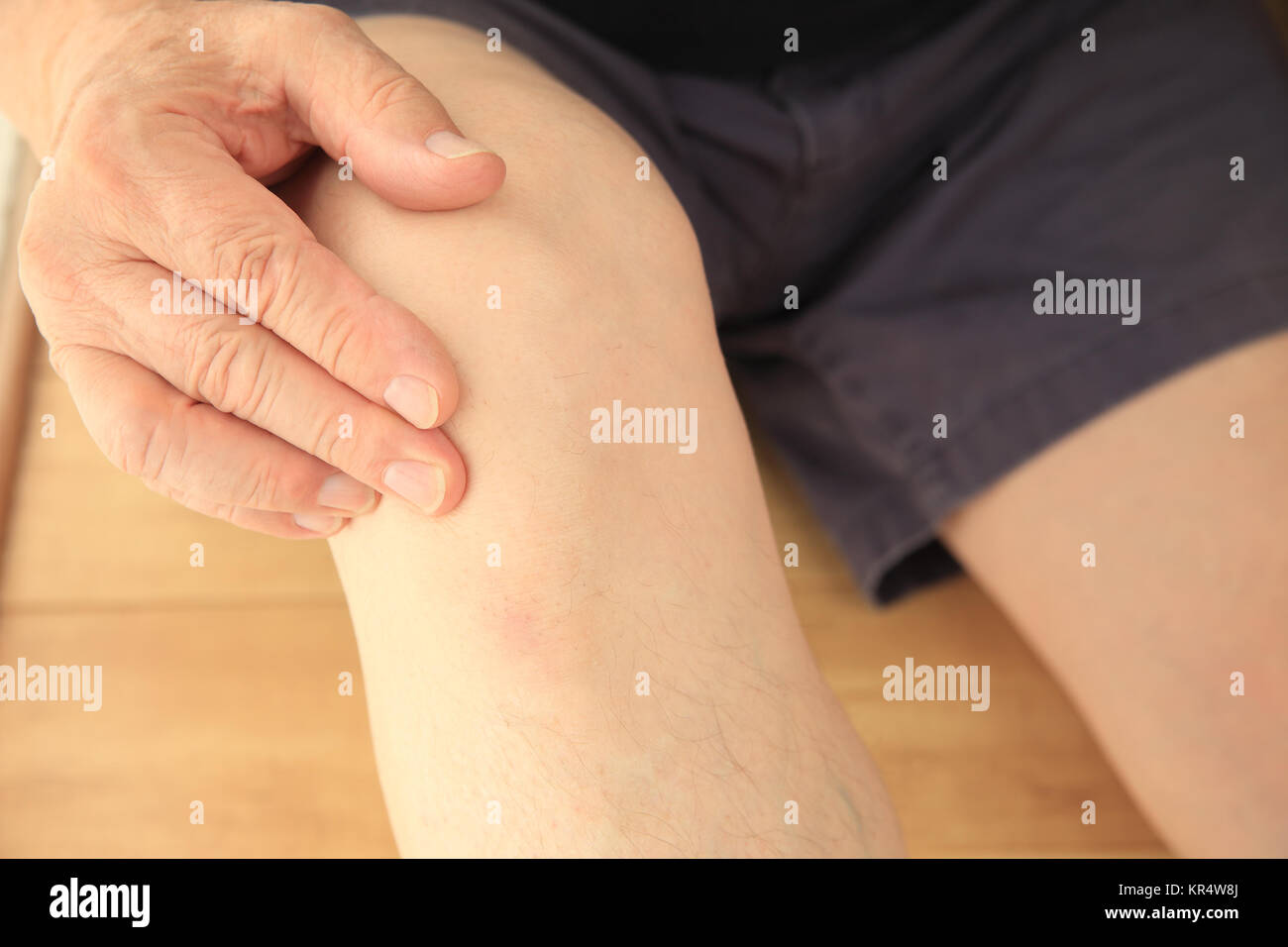 Bursite du genou Banque de photographies et d’images à haute résolution ...