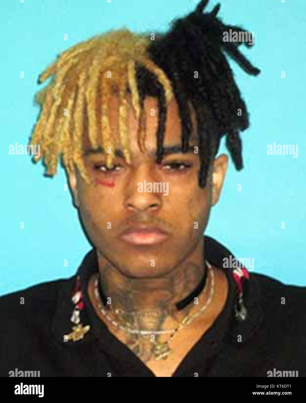 XXXTentacion Stage photo Photo Stock - Alamy
