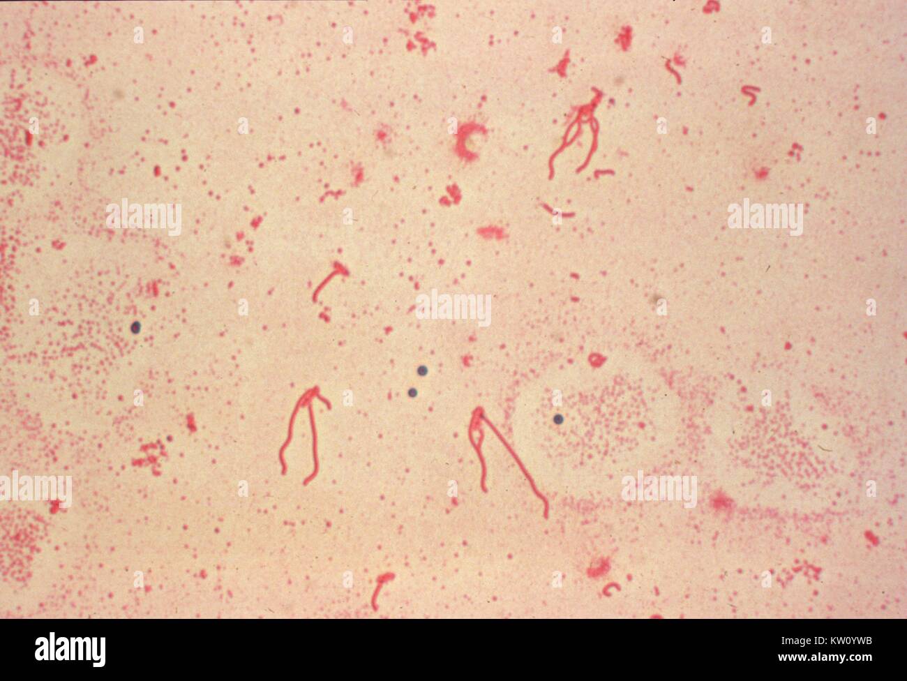 Yersinia pestis horizontal Banque de photographies et d’images à haute ...