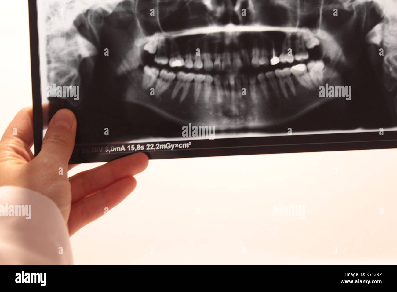 Radiographie des dents Banque de photographies et d’images à haute ...