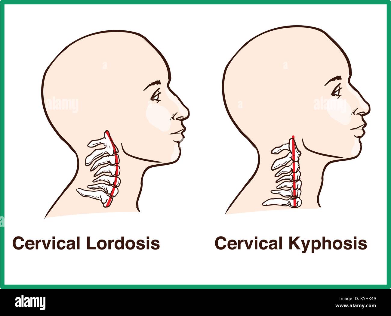 Cervical spine Banque d'images vectorielles - Alamy