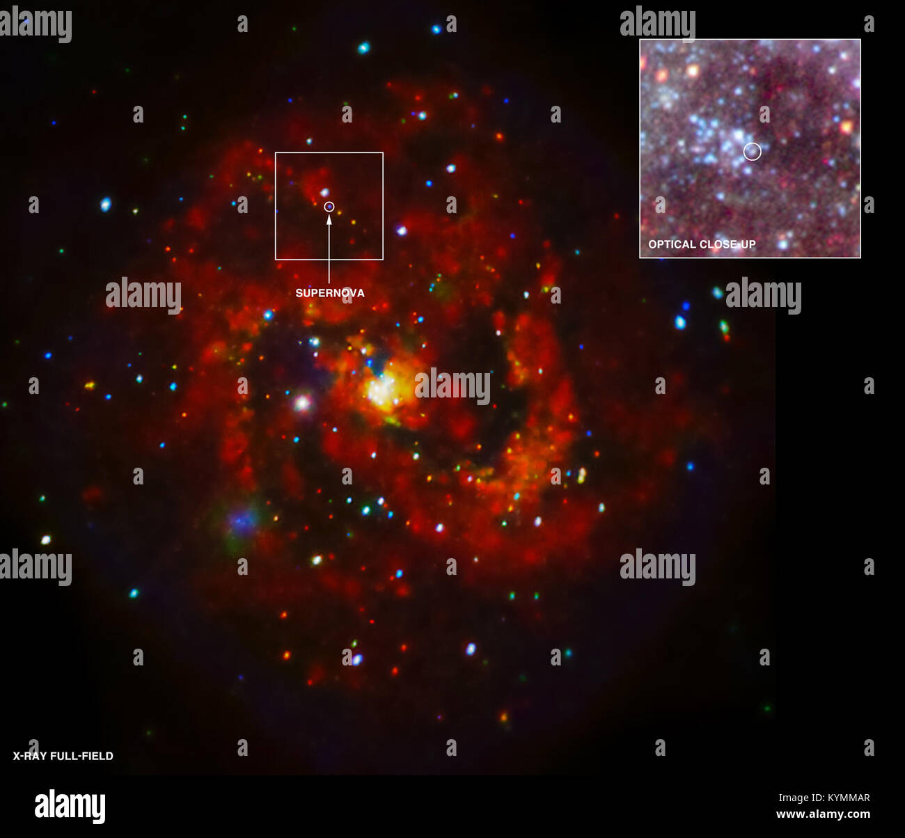 Une image historique capturant la découverte de rayons X d'un jeune ...