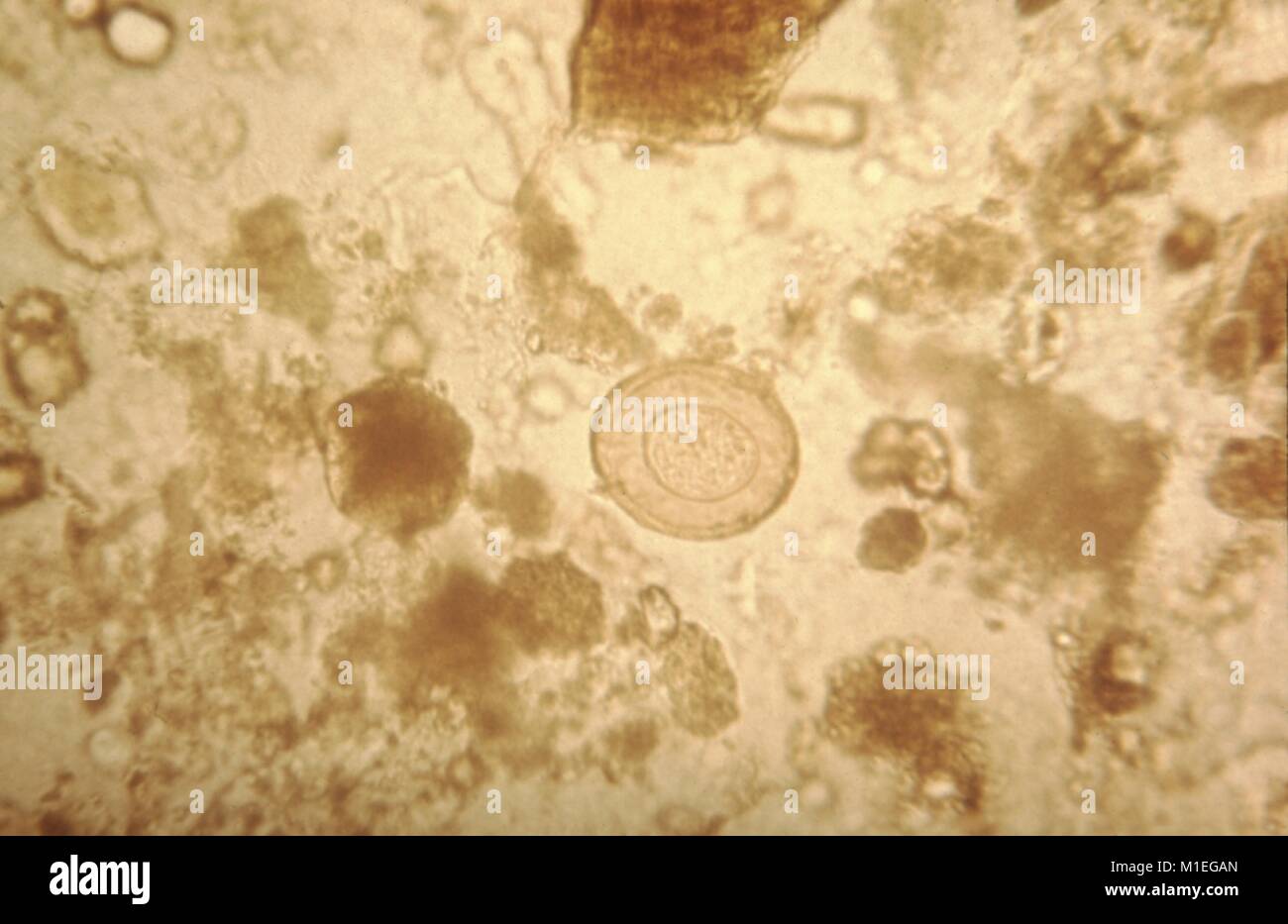 Oeufs De Ténia Dans Les Excréments Humains