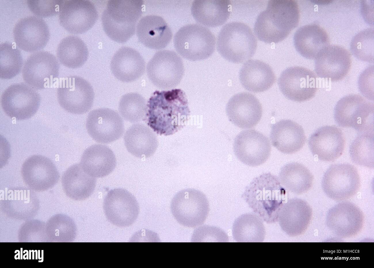 Photomicrographie de paludisme le parasite Plasmodium vivax, entraînant ...