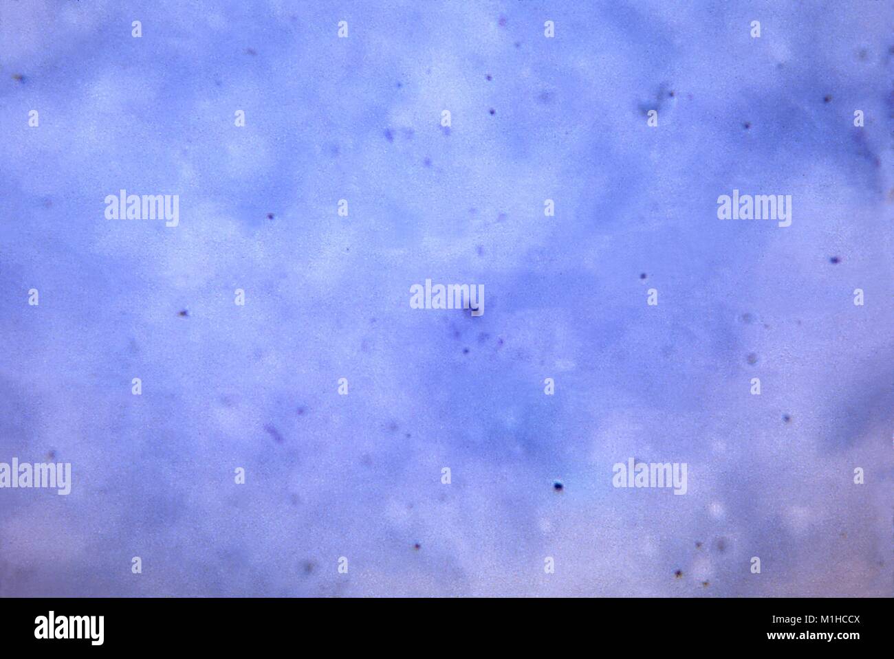 Photomicrographie de paludisme le parasite causant Plasmodium vivax ...