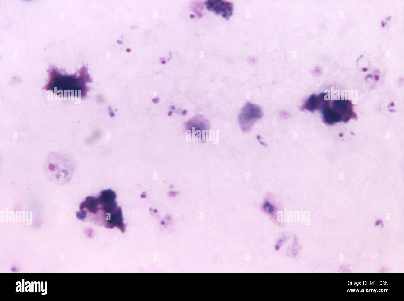 Photomicrograph of giemsa Banque de photographies et d’images à haute ...