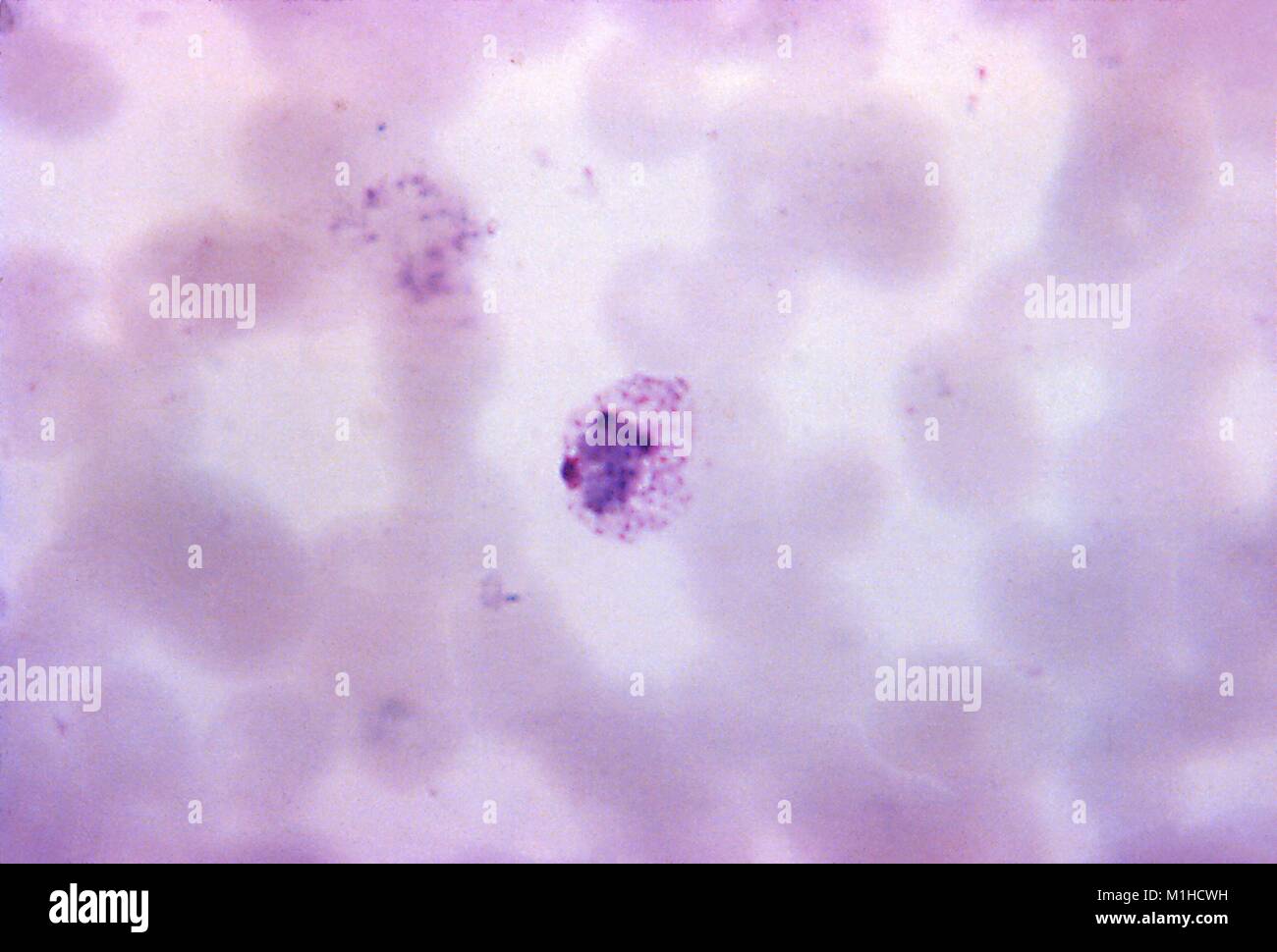 Photomicrographie de paludisme le parasite Plasmodium vivax, entraînant ...