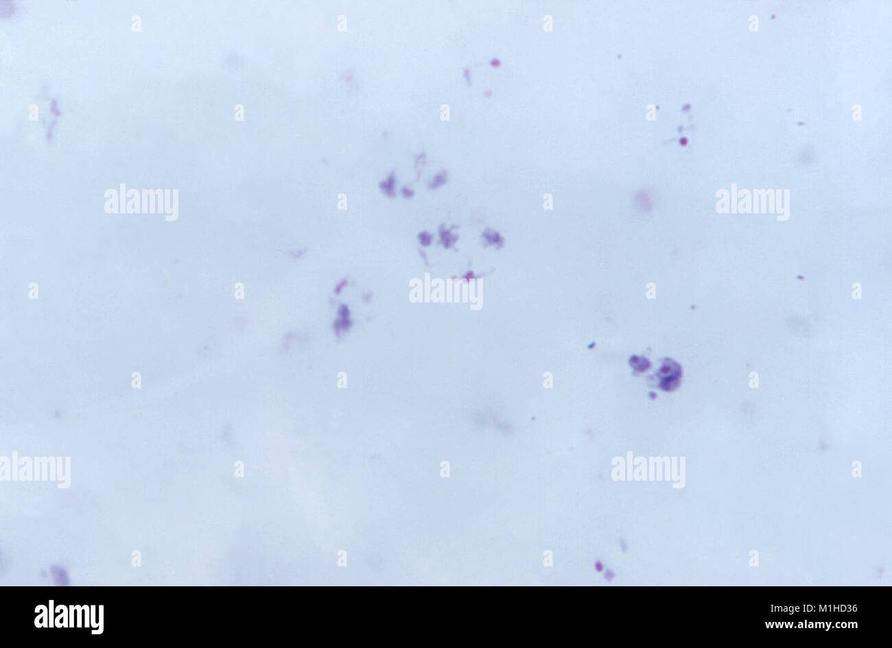 Photomicrographie du parasite du paludisme à Plasmodium vivax ...