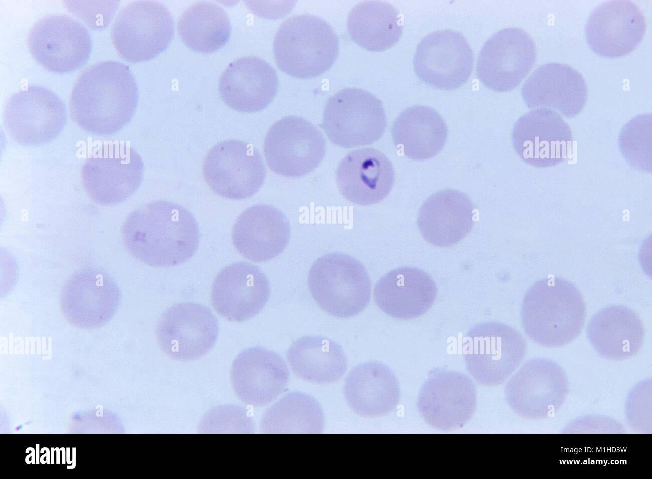 Photomicrographie du parasite du paludisme à Plasmodium vivax en forme ...