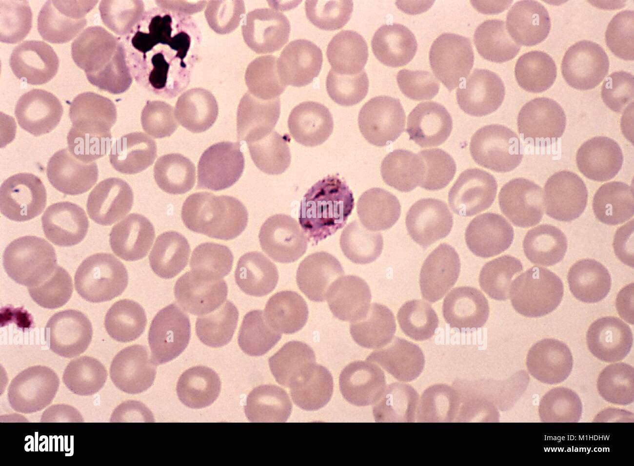 Photomicrograph of giemsa Banque de photographies et d’images à haute ...