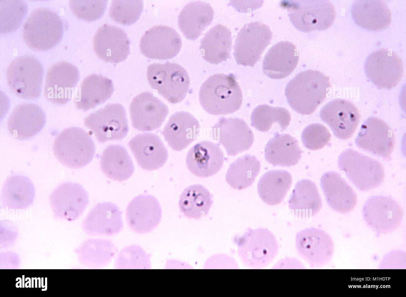 Plasmodium falciparum trophozoite Banque de photographies et d’images à ...