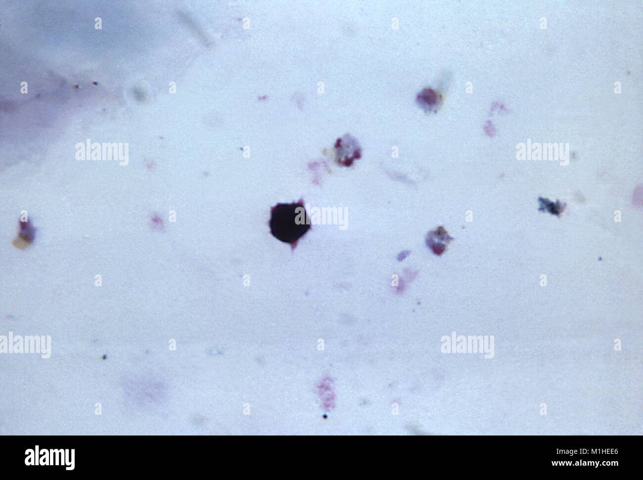 Photomicrographie du parasite du paludisme Plasmodium malariae présente ...