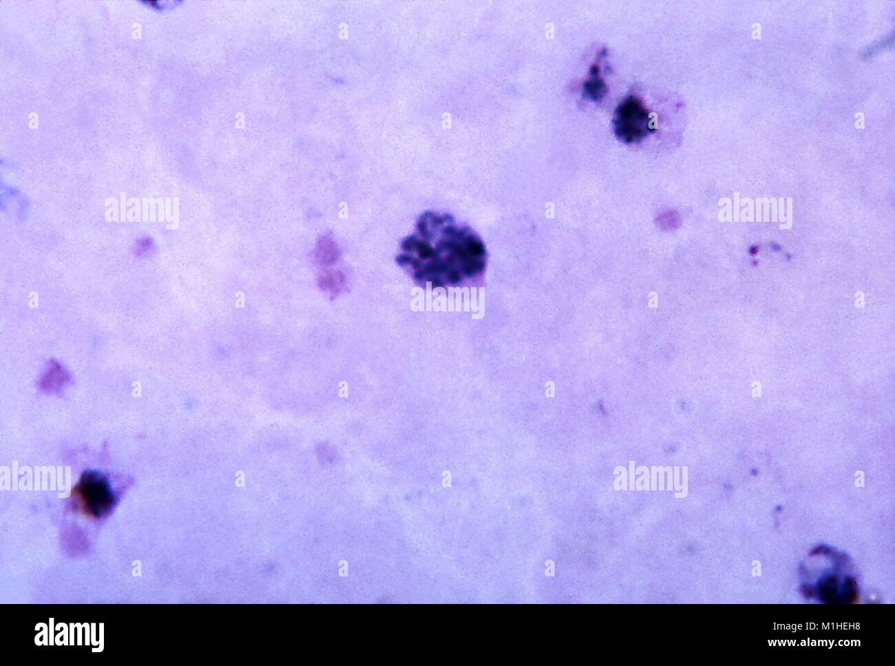 Photomicrographie du parasite du paludisme à Plasmodium vivax schizonte ...
