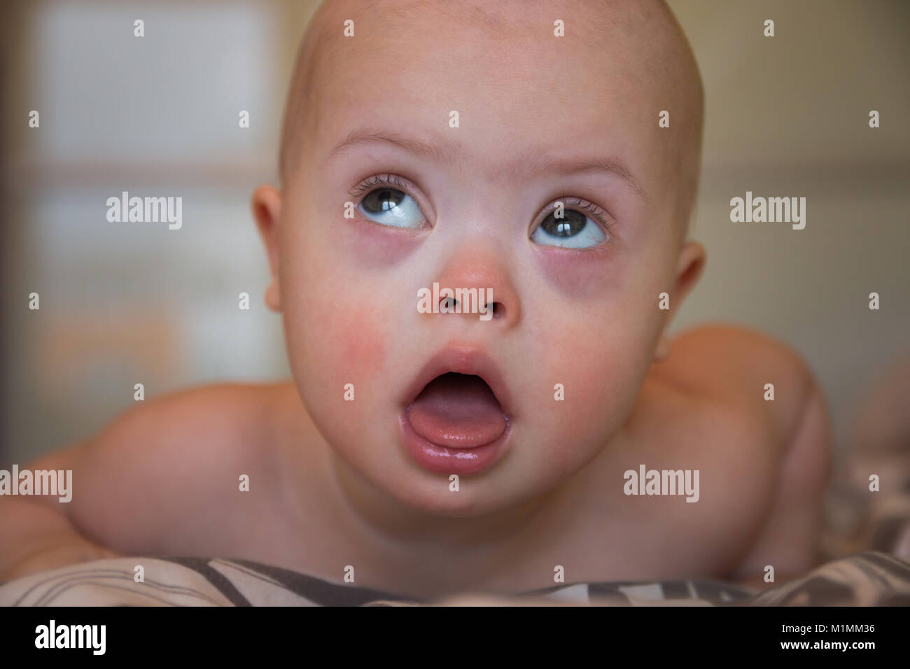 Portrait of cute baby boy avec le syndrome de Photo Stock - Alamy