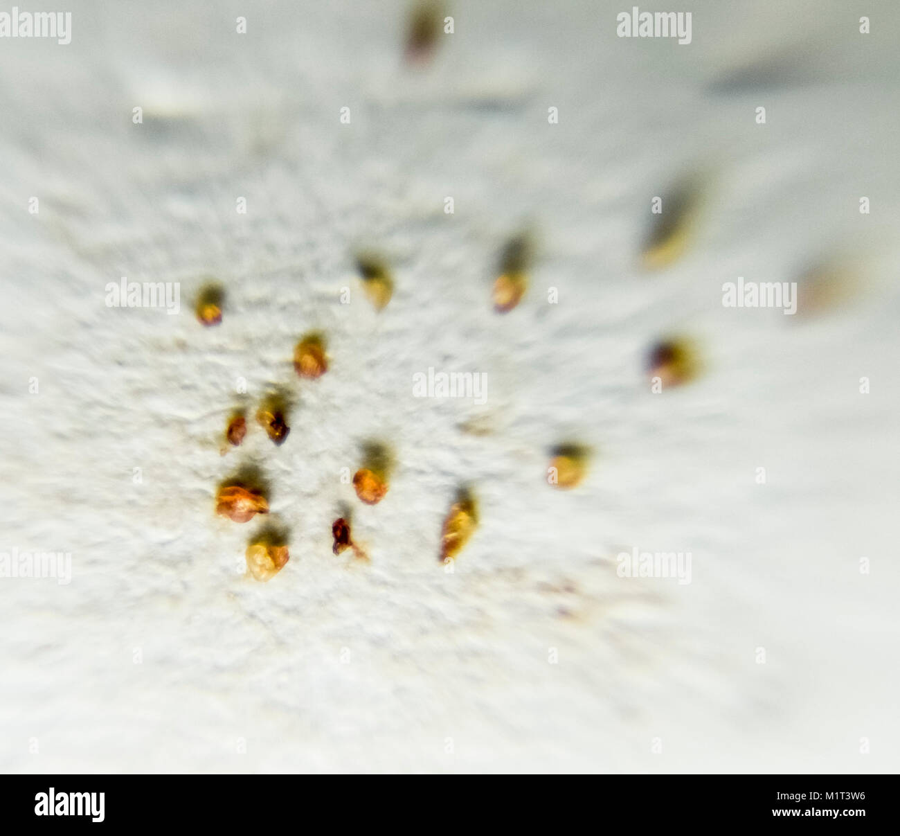 Parasite humain sous cutanée Banque de photographies et d’images à ...