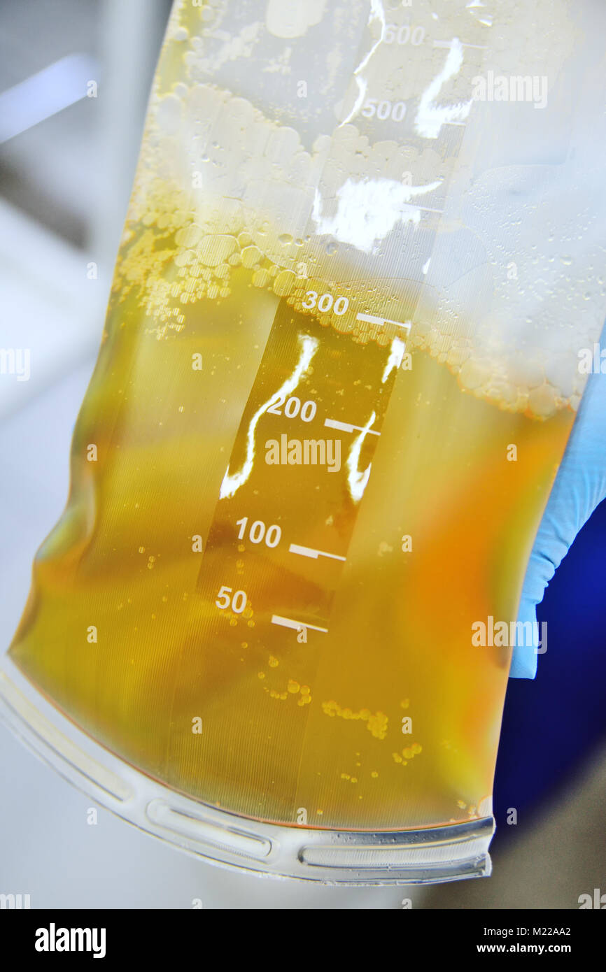 Sang transparent Banque de photographies et d’images à haute résolution ...