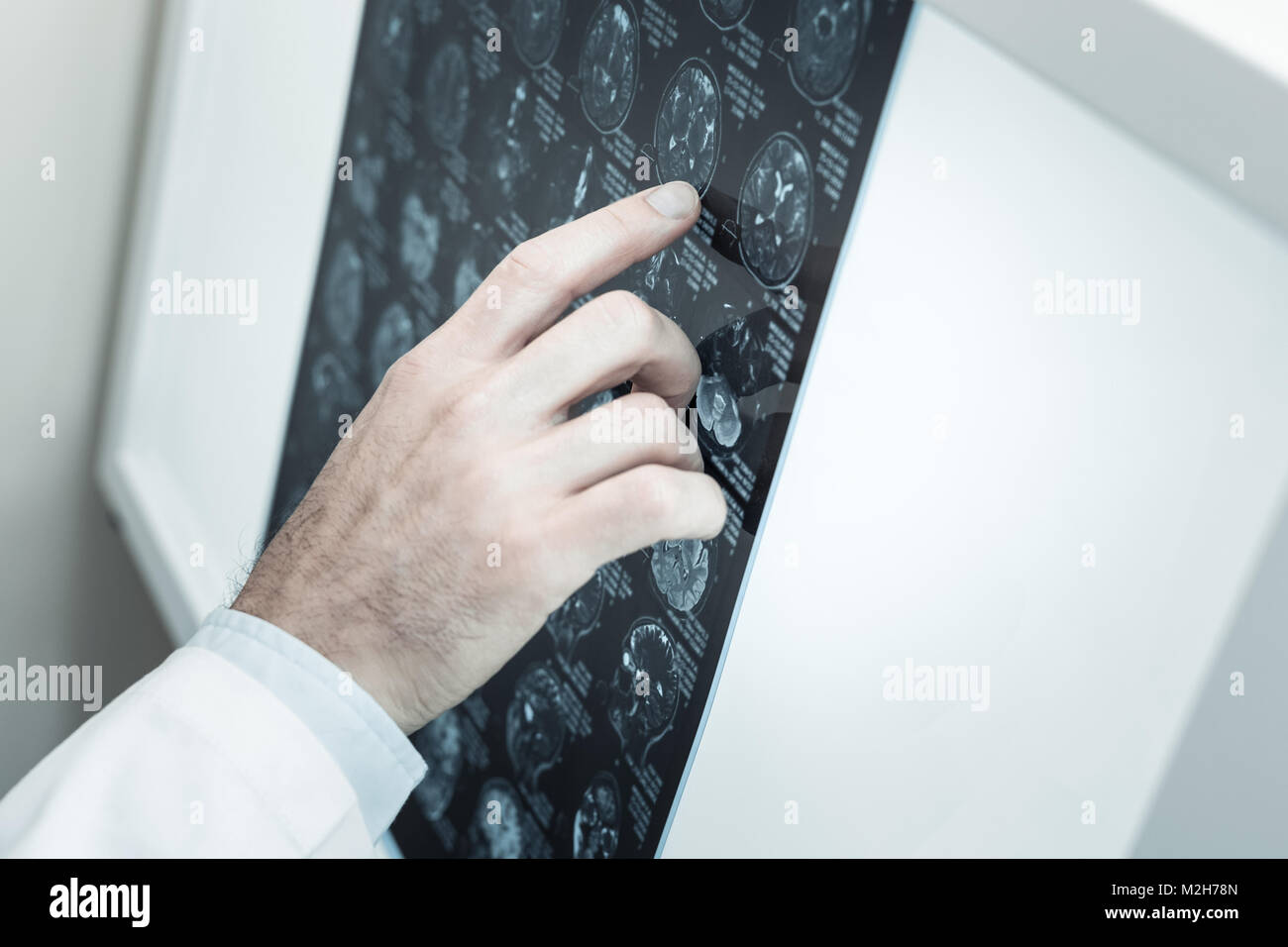 Scanner du cerveau Banque de photographies et d’images à haute ...