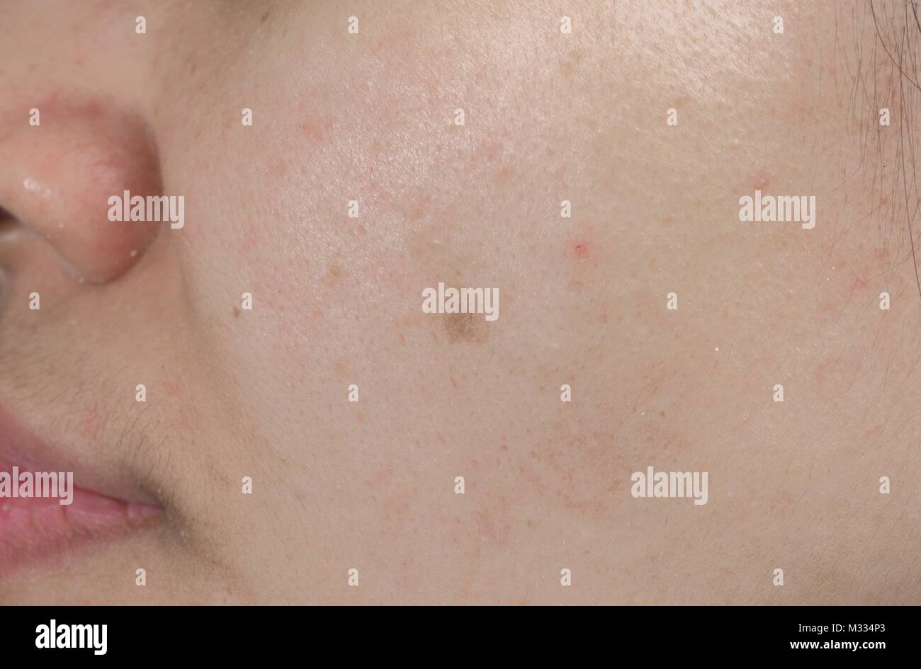 Boutons du visage Banque de photographies et d’images à haute ...
