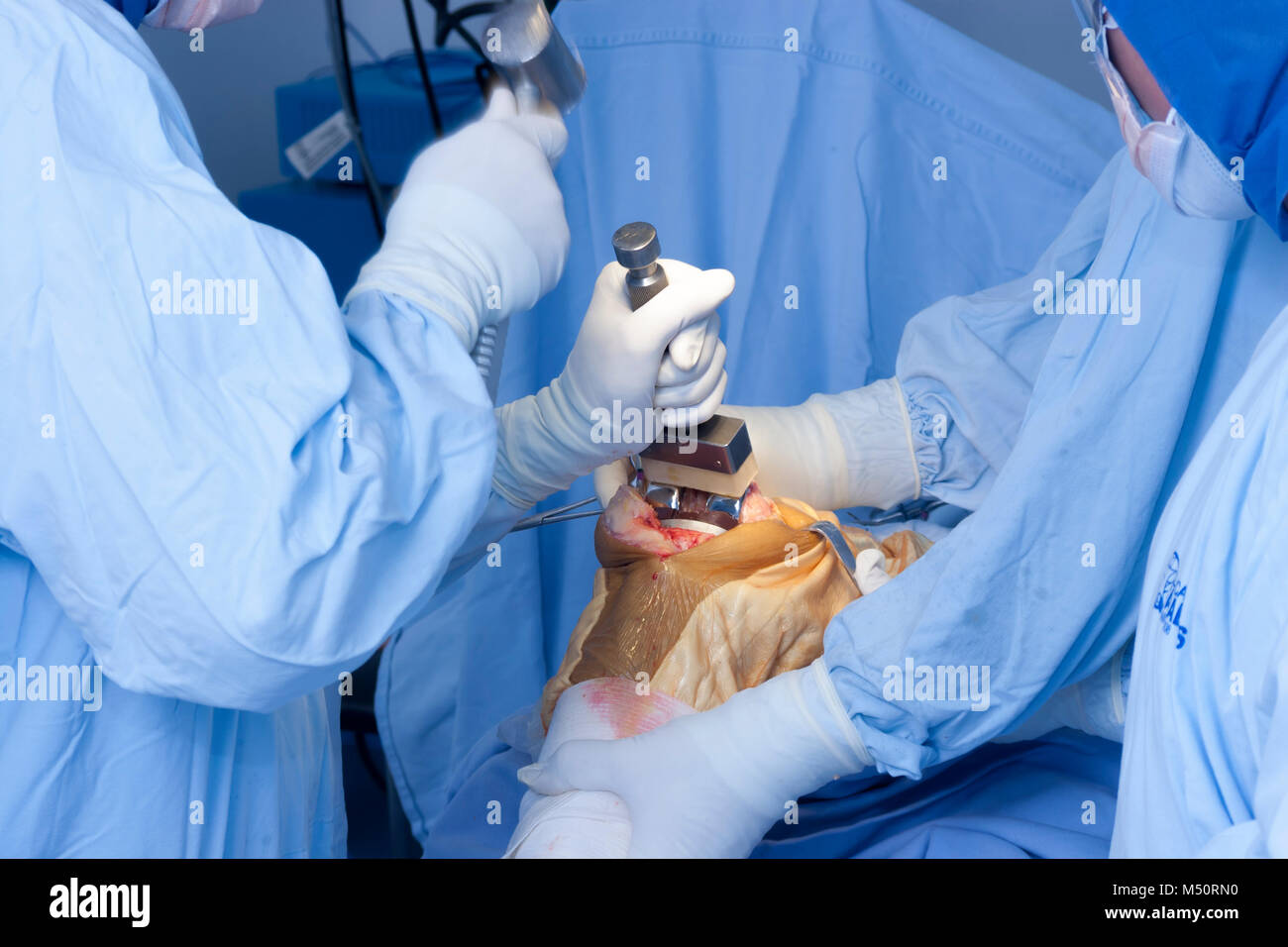 Détail de la chirurgie orthopédique, opération, chirurgie du genou ...