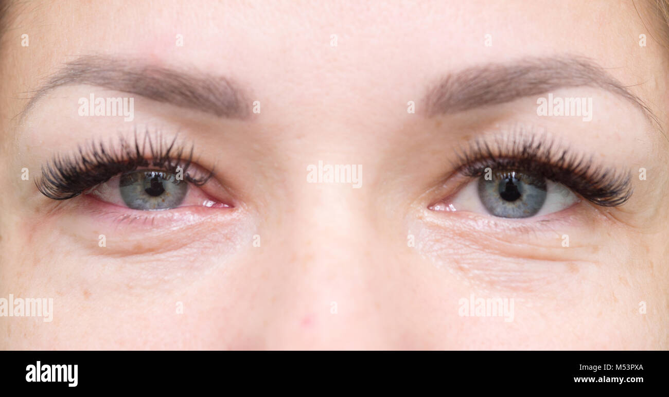 œil injecté de sang yeux Banque de photographies et d’images à haute ...