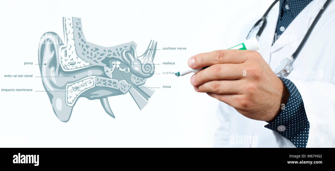 Cancer de l'oreille Banque d'image et photos - Page 2 - Alamy