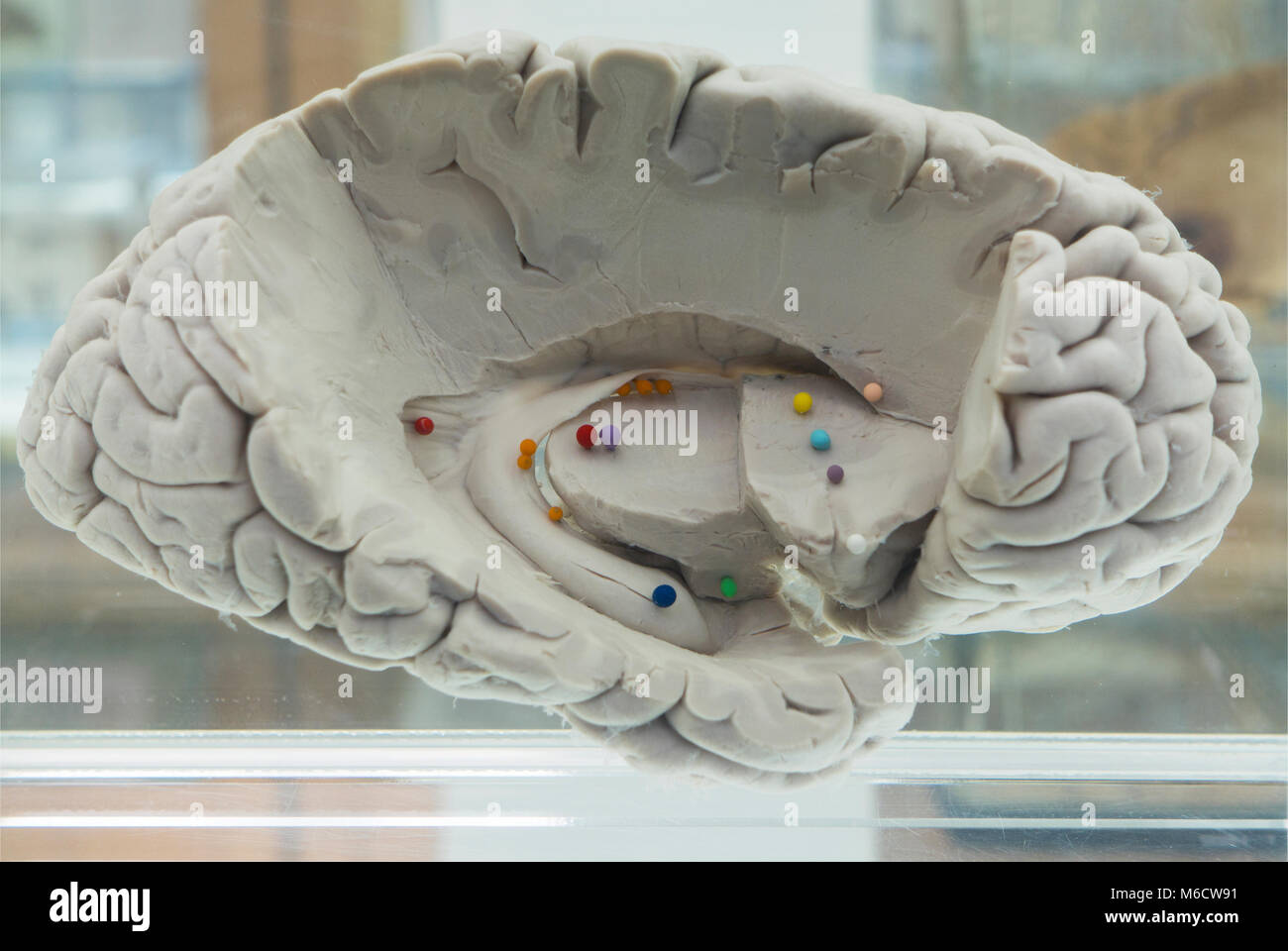 Capsule interne cerveau Banque de photographies et d’images à haute ...