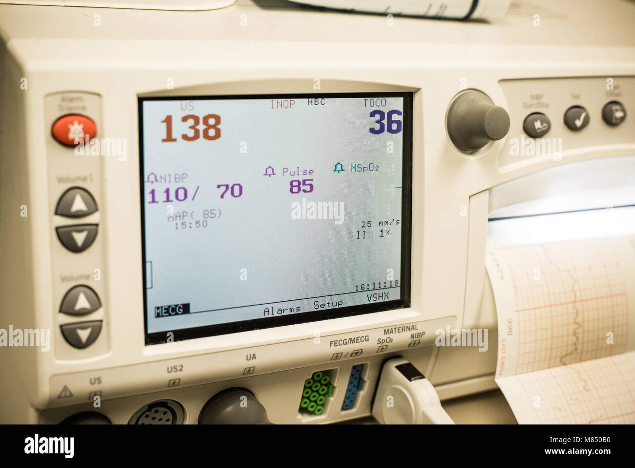 Appareil de cardiotocographie Banque de photographies et d’images à ...