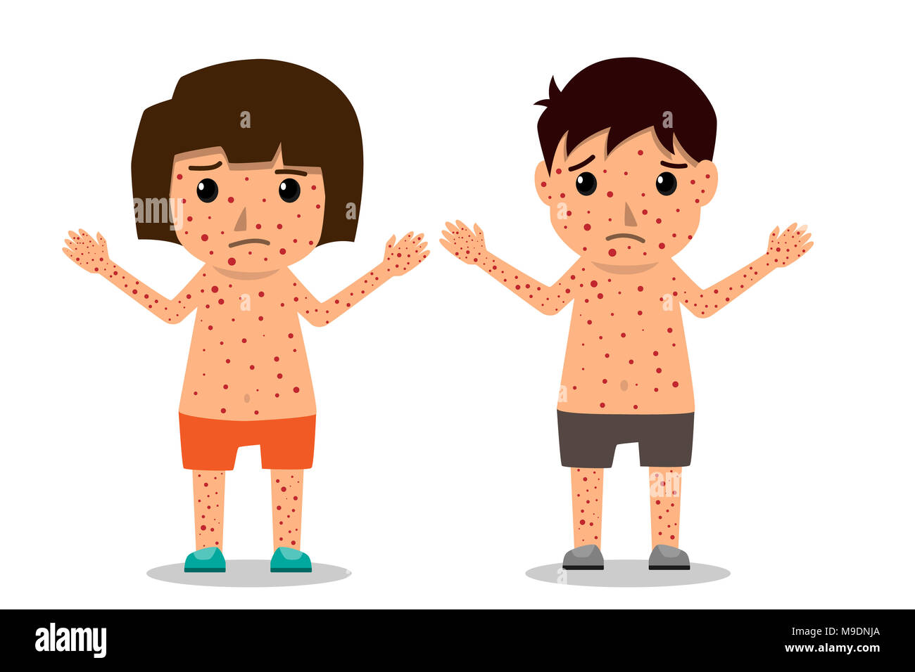 Les enfants ont la varicelle, l'infographie, les enfants de l'affiche ...