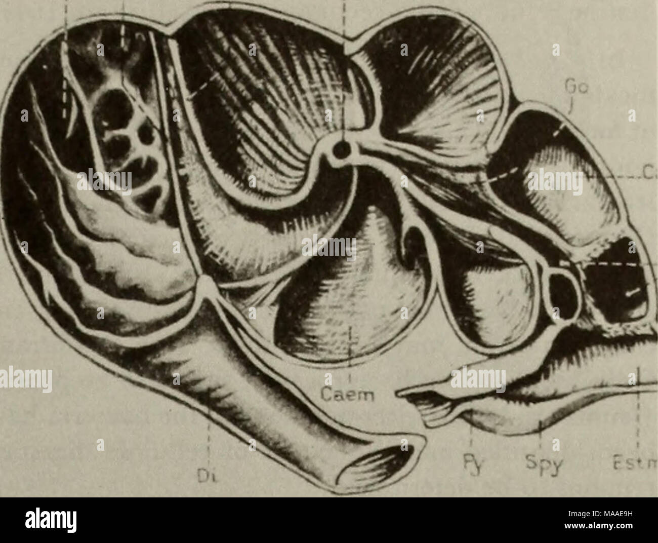 Diverticule oesophage Banque de photographies et d’images à haute ...