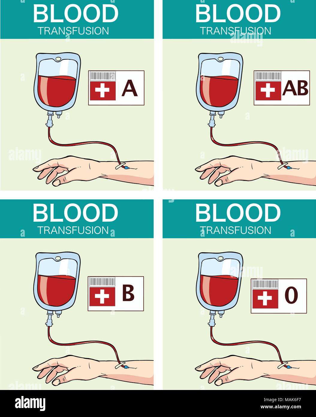 Transfusion sanguine Banque d'images vectorielles - Alamy