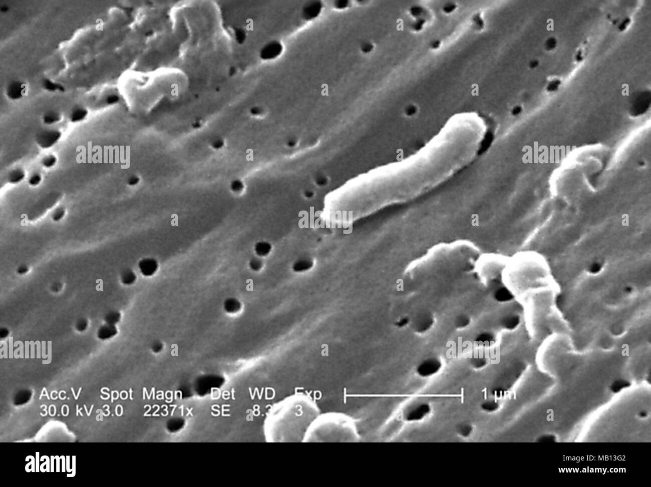 Les bactéries Vibrio cholerae révélé dans les 22371x amplifiés en ...