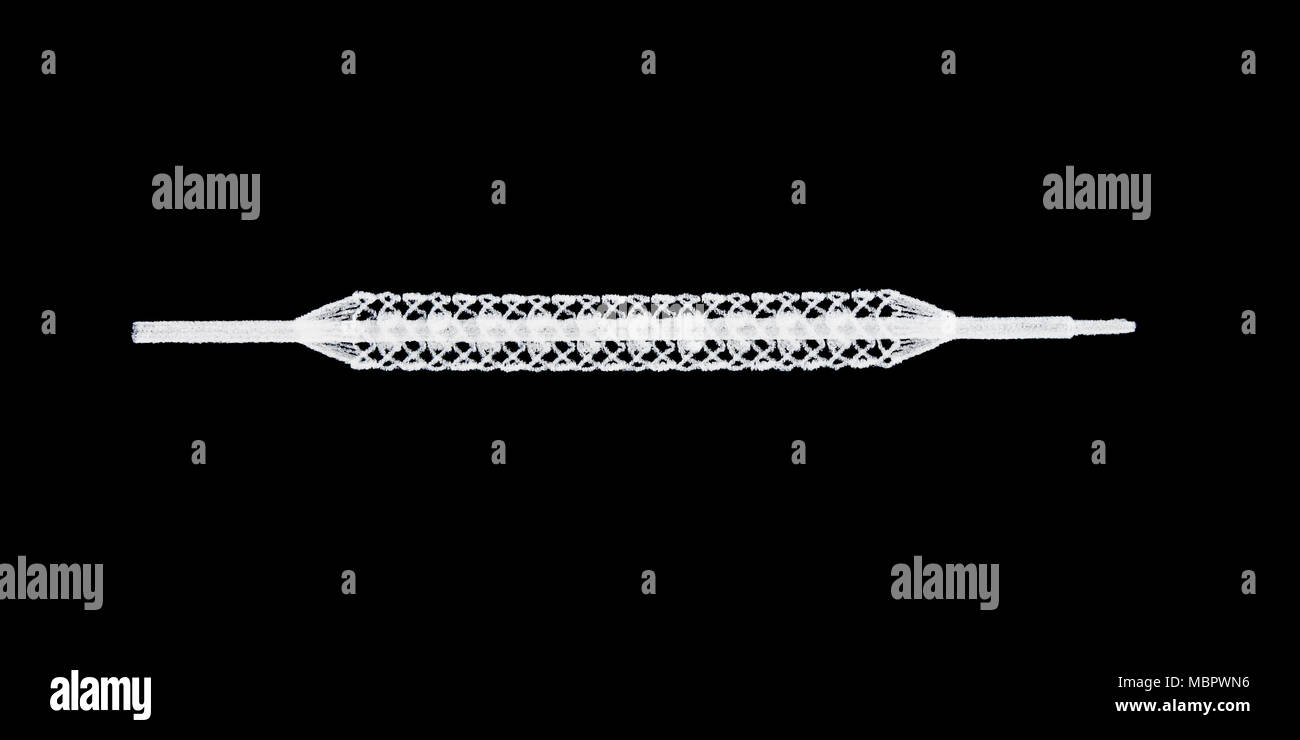 Modèle d'un stent cardiaque isolé sur fond noir Photo Stock - Alamy