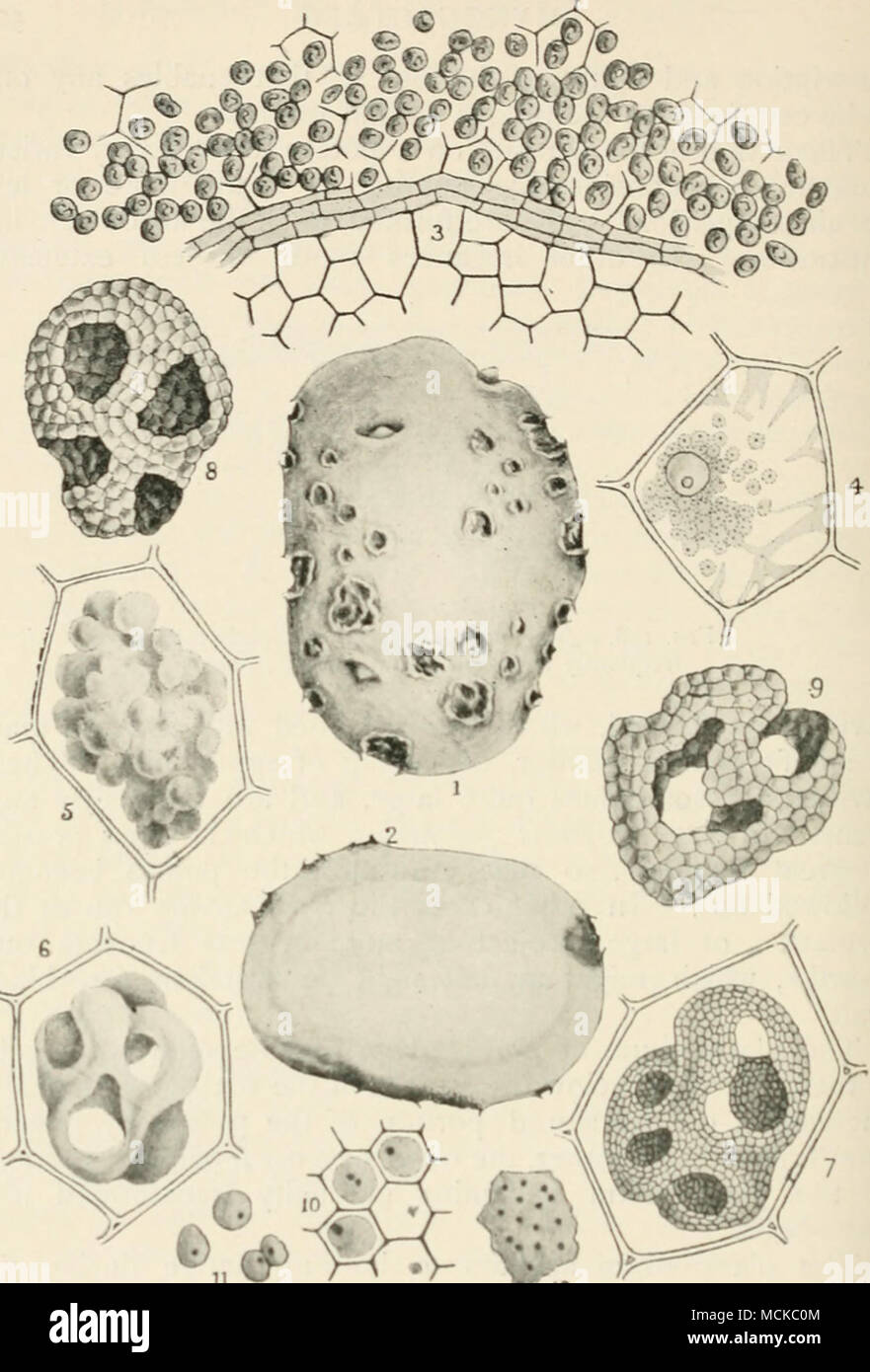 . Fig. 159.-Spongospora la gale. 1, tuber montrant wuunds effectuée au ...