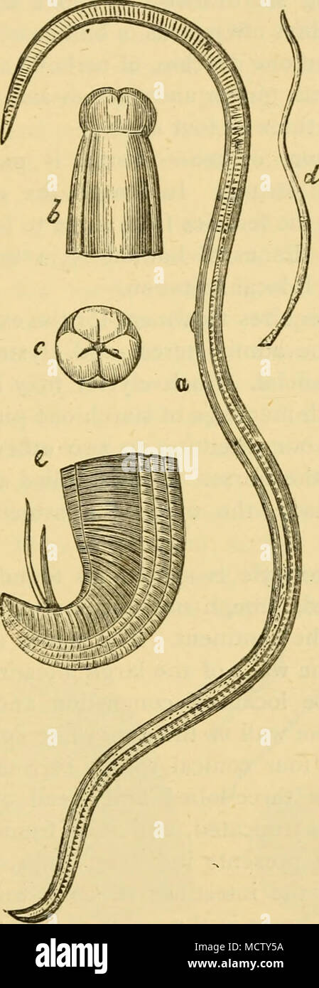 . ASCARIS LUMBRICOIDES. Une femme, Ascaris lumbricoides. B, extrémité ...