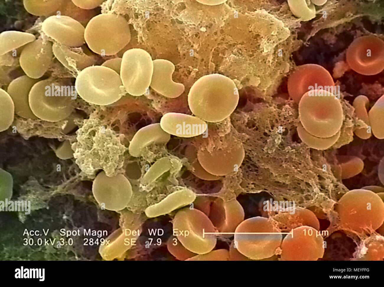 White blood cell electron micrograph Banque de photographies et d ...