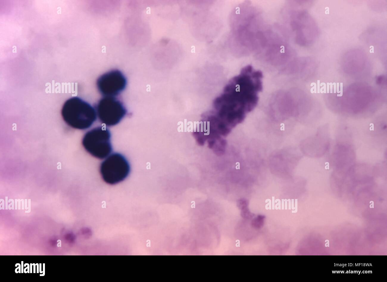 Les globules blancs (leucocytes), une pile de plaquettes, et les ...