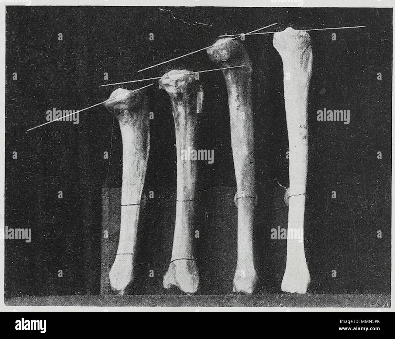 Terminologie anatomique Banque de photographies et d’images à haute ...