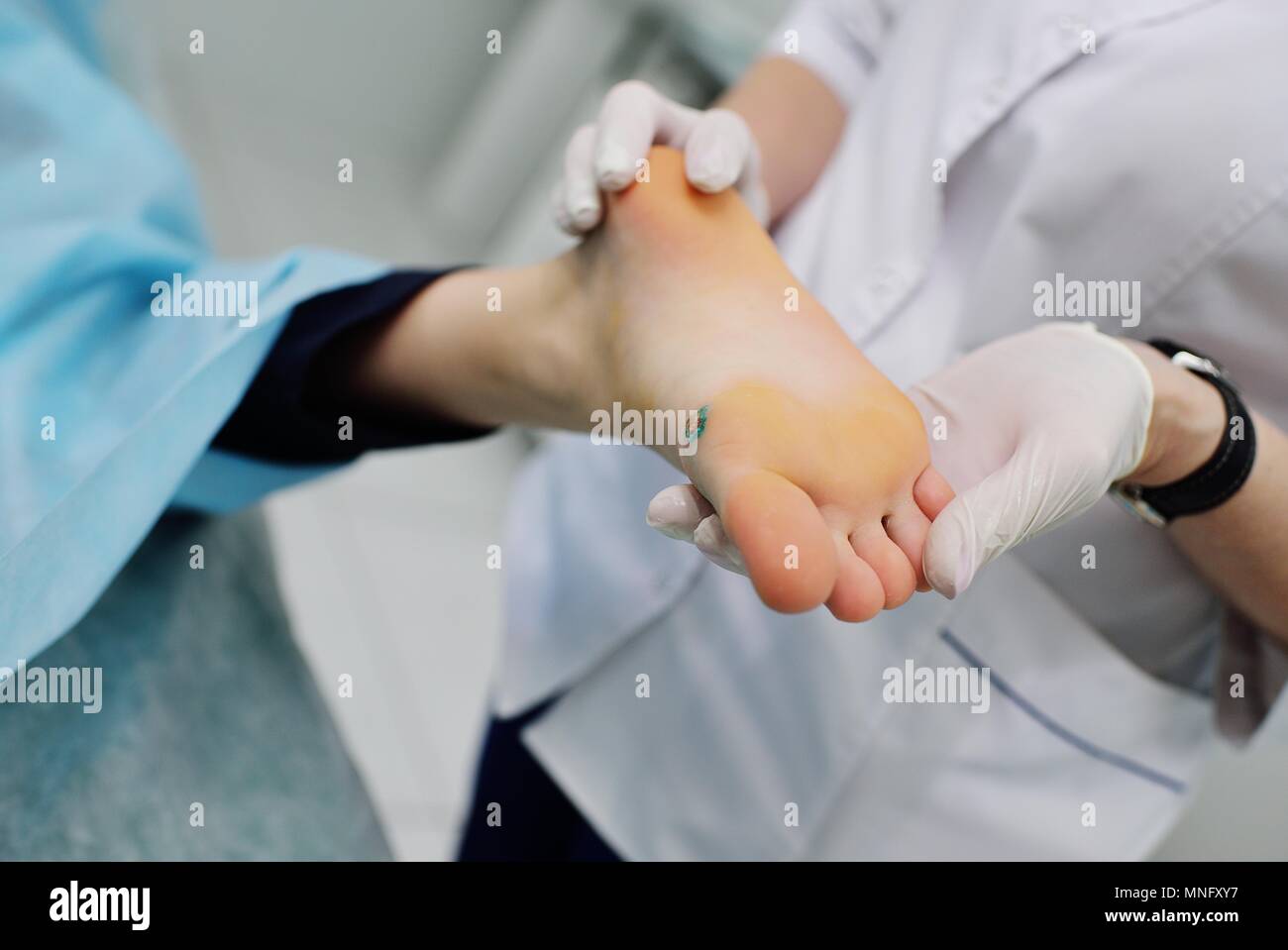 Cancer du pied Banque de photographies et d’images à haute résolution ...
